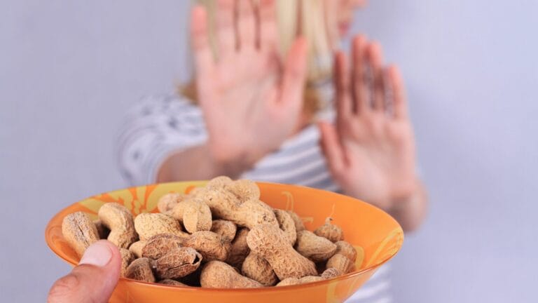 Peanut Allergy Causes Symptoms and Treatment