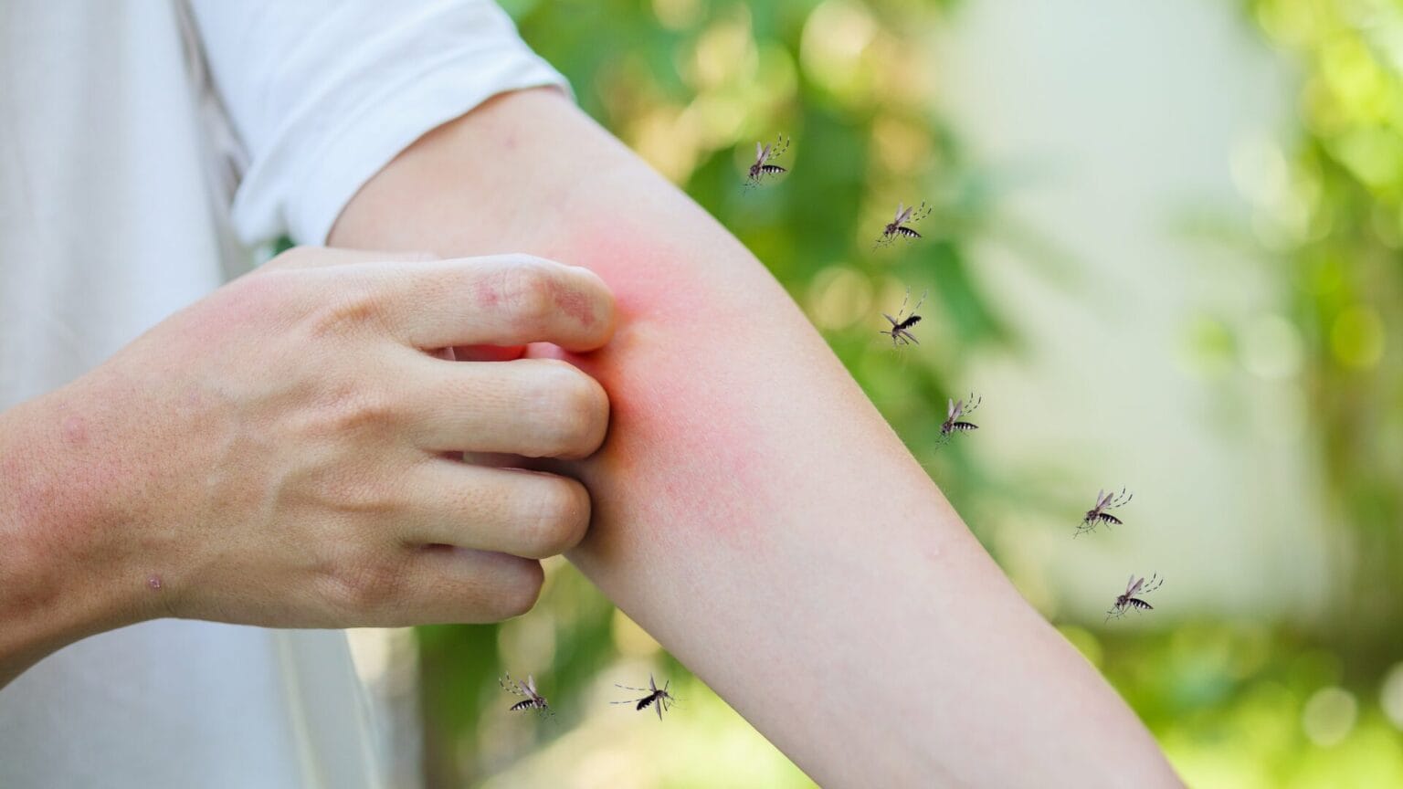 Step-by-Step Guide: Managing Allergic Reactions to Insect Stings